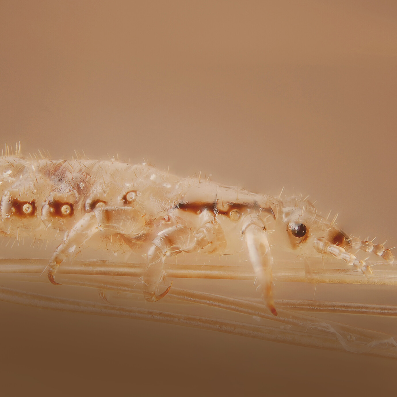 The louse that defeated Napoleon in Russia | Meer