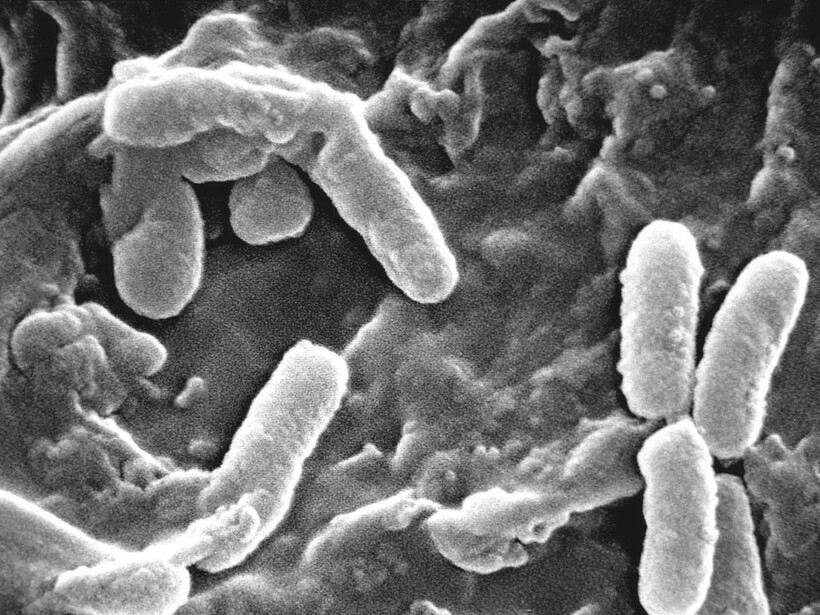 How gut bacteria shift in IBD reveals new insights | Meer