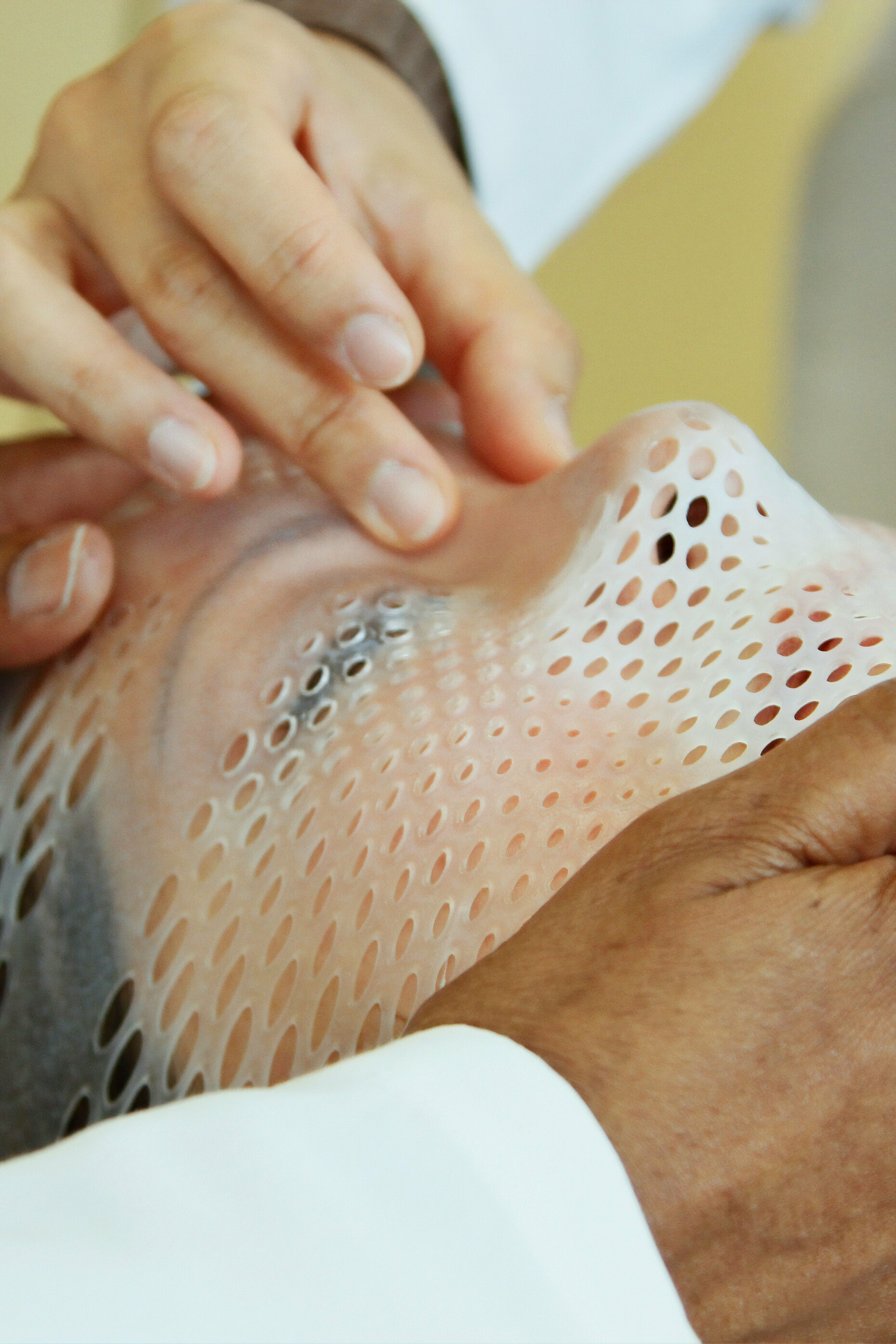 The gene-altering effects of anethol in cancer cells | Meer